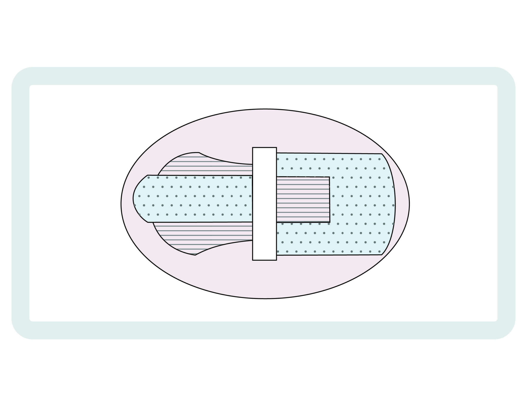 Securement Device | TillaCare - UriCap Female