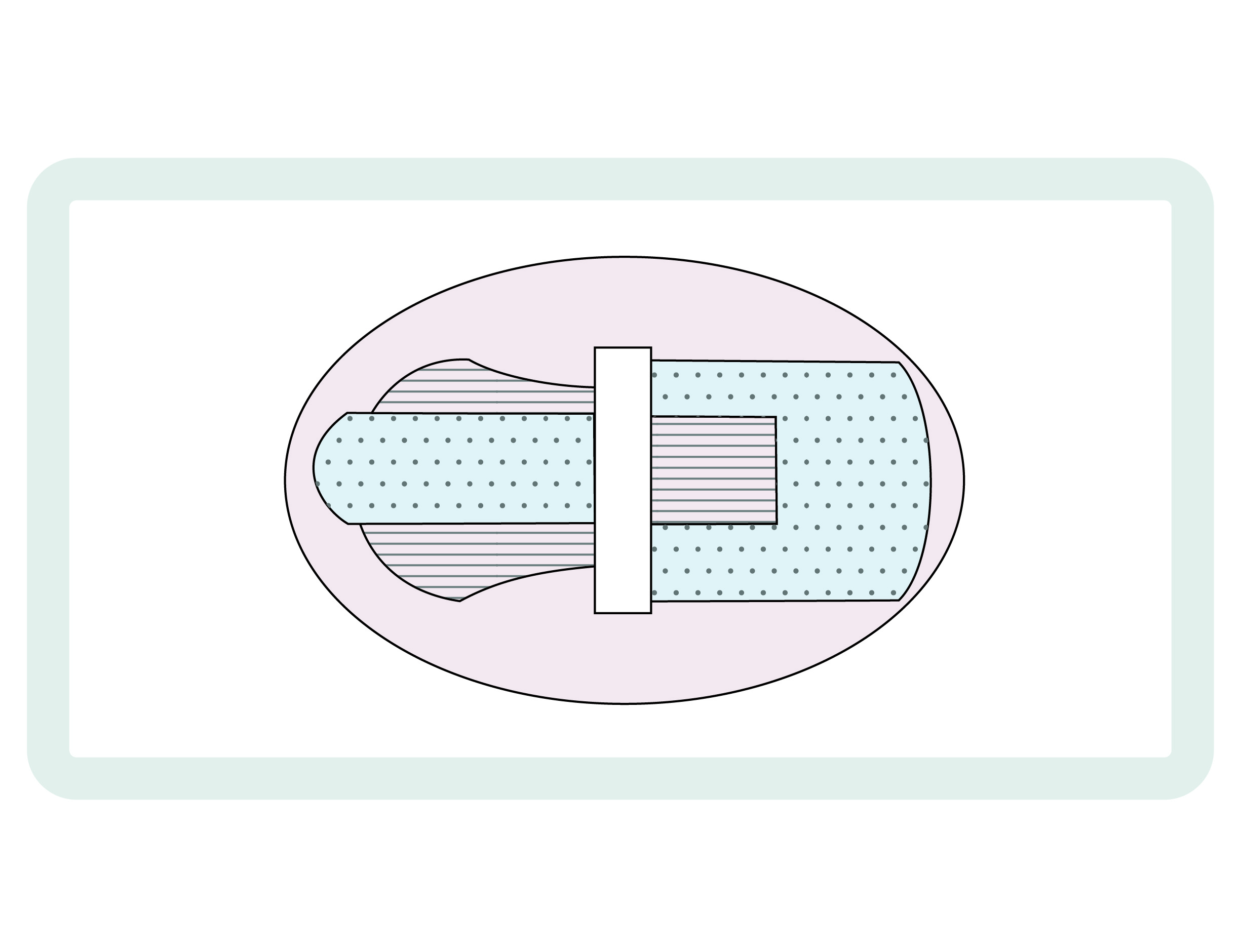 Securement Device | TillaCare - UriCap Female