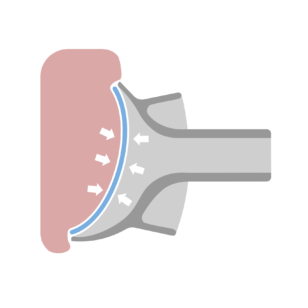 TillaCare - UriCap Female | Cutting edge urine collection for incontinence
