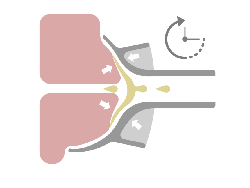 External Female Catheter for Home Use | UriCap by TillaCare
